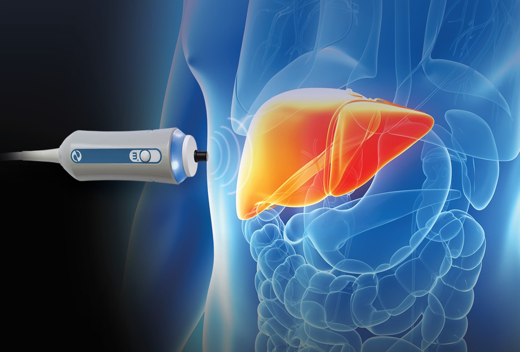 Fatty liver disease and the FibroScan® test – Precision Digestive Care